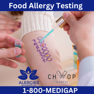 Food Allergy Testing